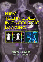 New Techniques in Oncologic Imaging - 1st Edition - Alexander M. Gorba