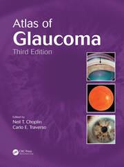 Atlas of Glaucoma - 3rd Edition - Neil T. Choplin - Carlo E. Traverso