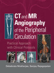CT and MR Angiography of the Peripheral Circulation: Practical Approac