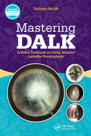 Mastering DALK: A Video Textbook on Deep Anterior Lamellar Keratoplast