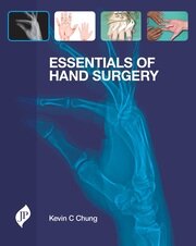 Essentials of Hand Surgery - 1st Edition - Kevin C. Chung - Routledge