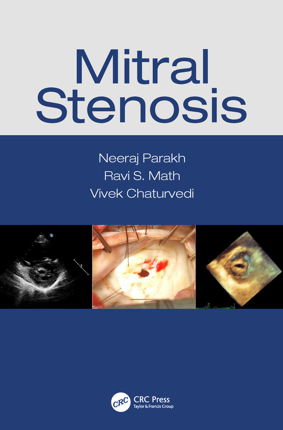mitral-stenosis-1st-edition-neeraj-parakh-ravi-s-math-vivek